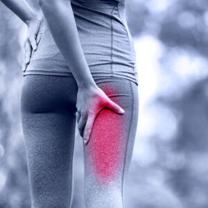 Proximal Hamstring Tendinopathy | Causes and Treatment
